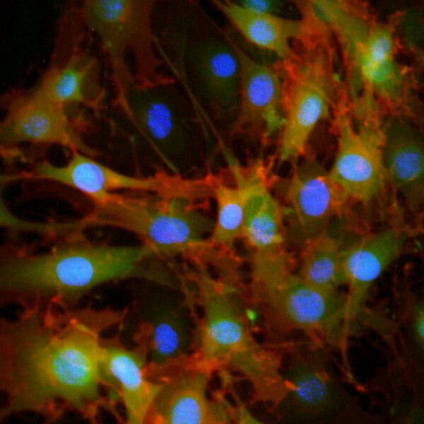 OP9-DL1 hDL-1-Expressing mOP9 Cell Line | SCC136